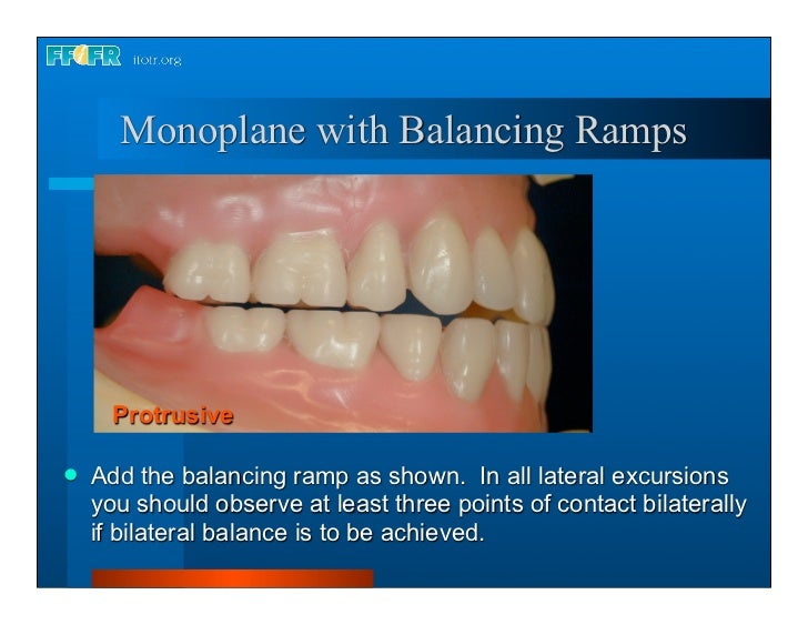 18.occlusal schemes monoplane with balancing ramps