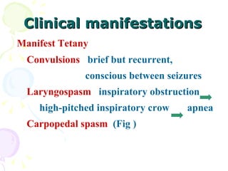 18 Rickets Of Vitamin D Deficiency,Tetany Of Vitamin D Deficiency | PPT