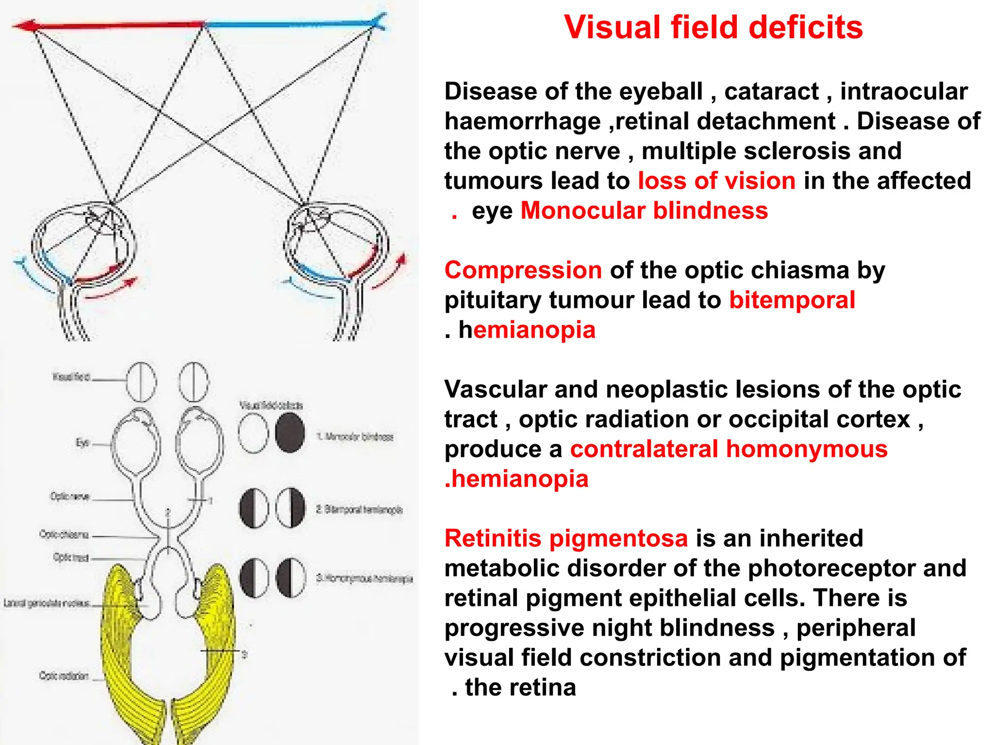 Anatomy of visual pathways an eye presentation | PPT