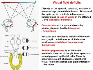 Anatomy of visual pathways an eye presentation | PPT