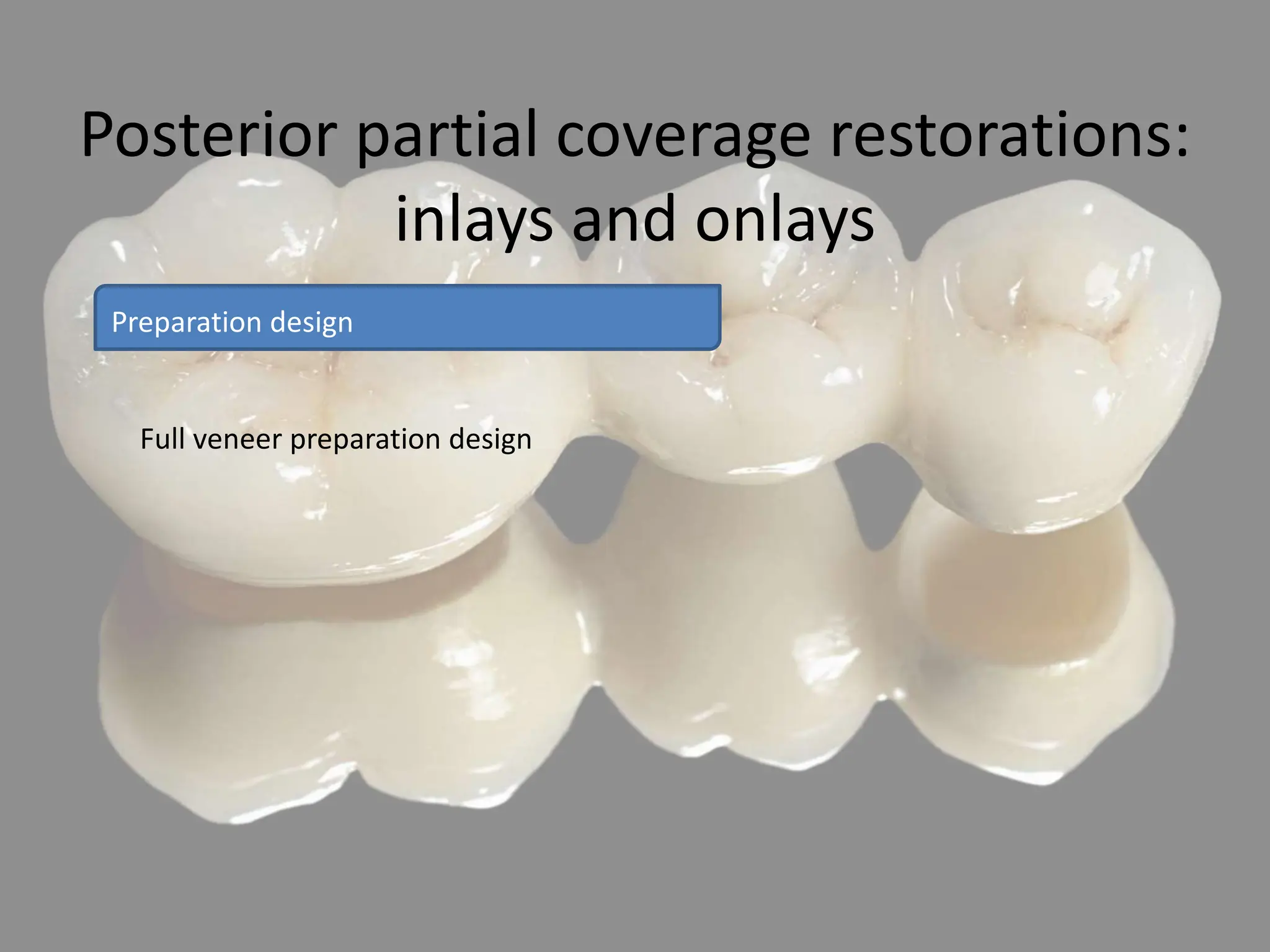 180. CERAMIC RESTORATIONS and prepration.pptx