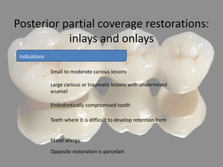 180. CERAMIC RESTORATIONS and prepration.pptx