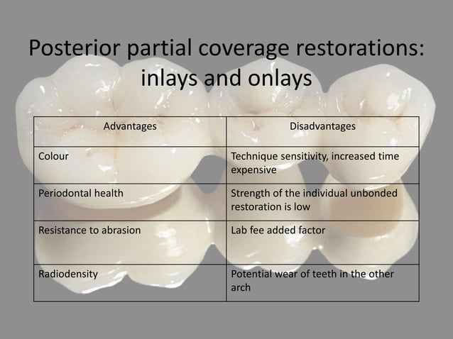 180. CERAMIC RESTORATIONS and prepration.pptx