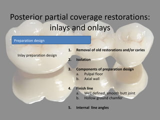 180. CERAMIC RESTORATIONS and prepration.pptx