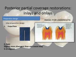 180. CERAMIC RESTORATIONS and prepration.pptx