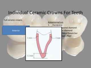 180. CERAMIC RESTORATIONS and prepration.pptx