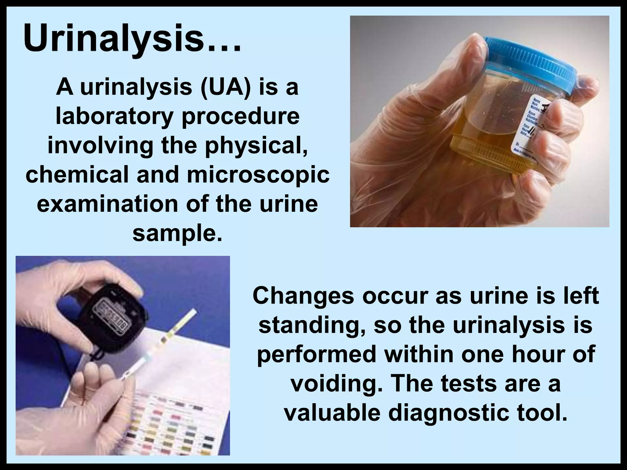 180-anatomy-uninary-system.ppt