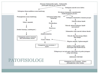 180219037-PPT-DEMAM-TIFOID-pptx.pptx