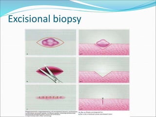 181260748-medical science Biopsy-ppt-oral-pathology.ppt