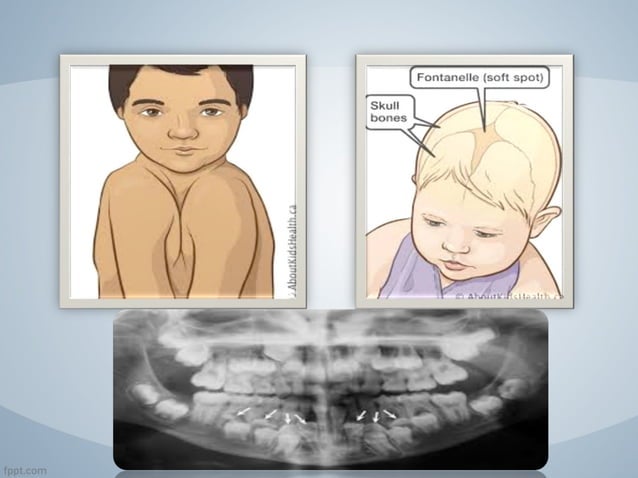 developmental anomalies of teeth | PPT | Dental Health | Diseases and ...