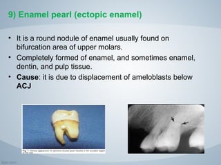 developmental anomalies of teeth | PPT