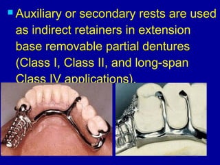 rest and rest seat | PPT