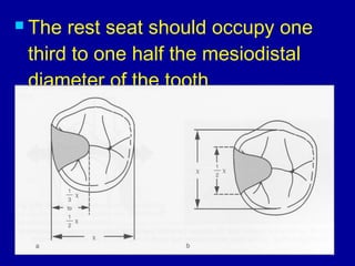 rest and rest seat | PPT