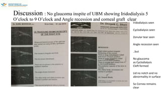 A Case Of Chopper Assault Injury Managed With Three Stage Surgical ...