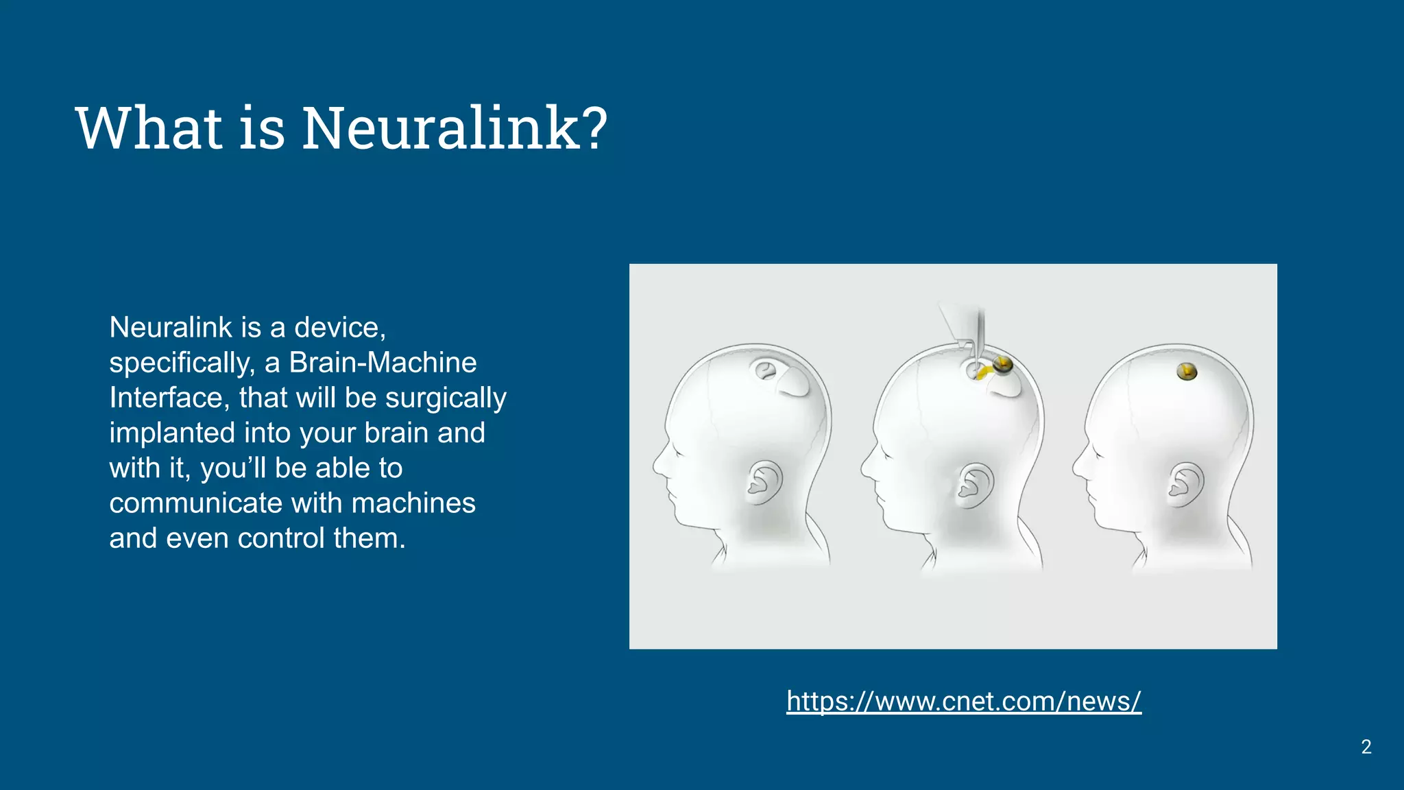 Neuralink Seminar ppt | PDF