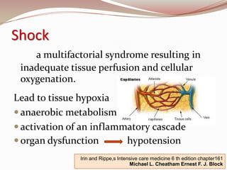 Approach to Shock and Hemodynamics | PPT
