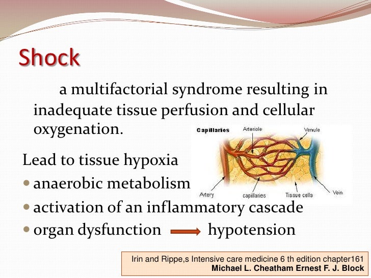 Approach to Shock and Hemodynamics