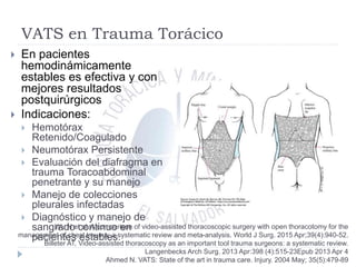 18 Actualizaciones en Trauma Torácico.pptx