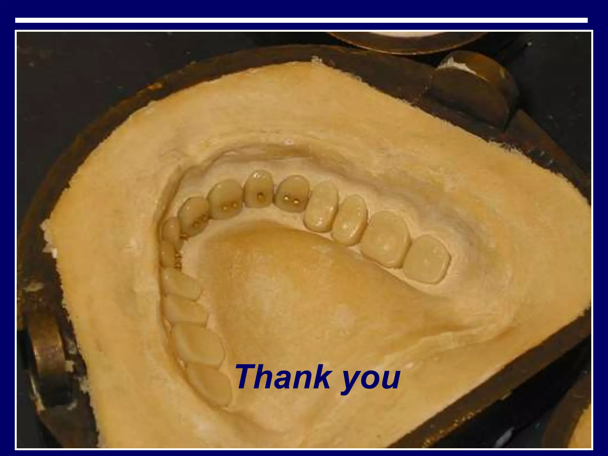 artificial denture teeth dental material | PPT