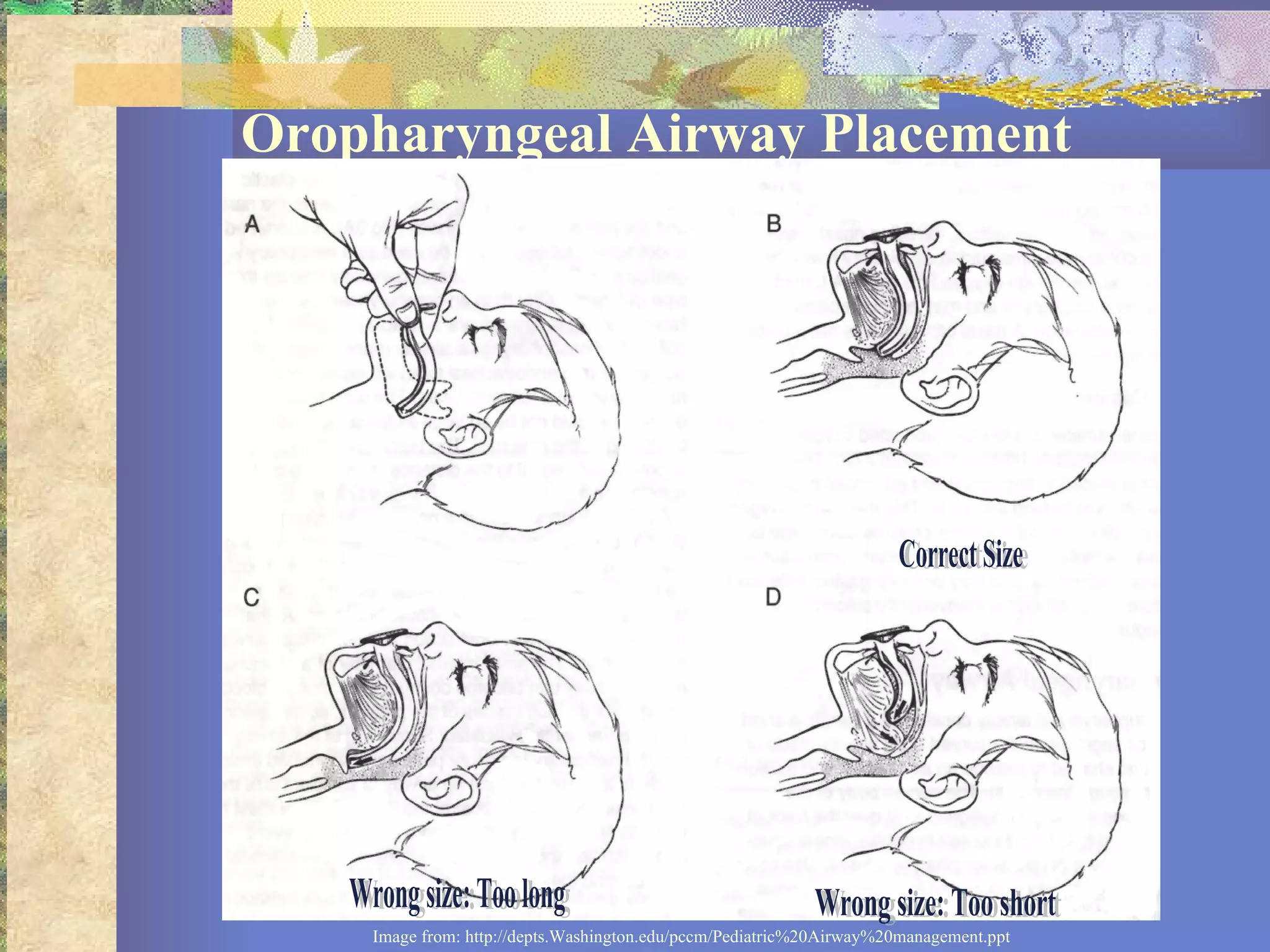 18 basics of pediatric airway anatomy, physiology and management | PPT
