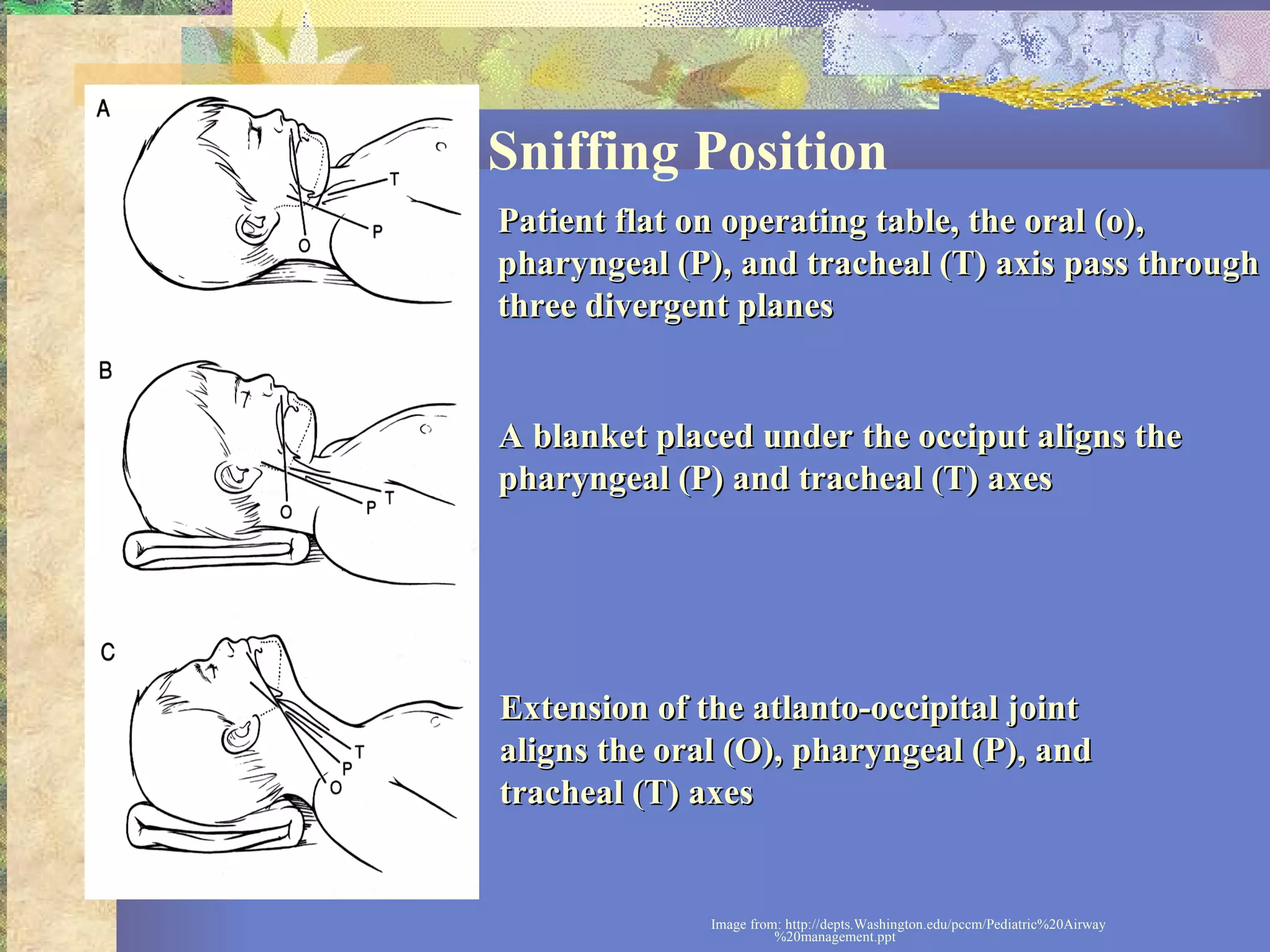 18 basics of pediatric airway anatomy, physiology and management | PPT