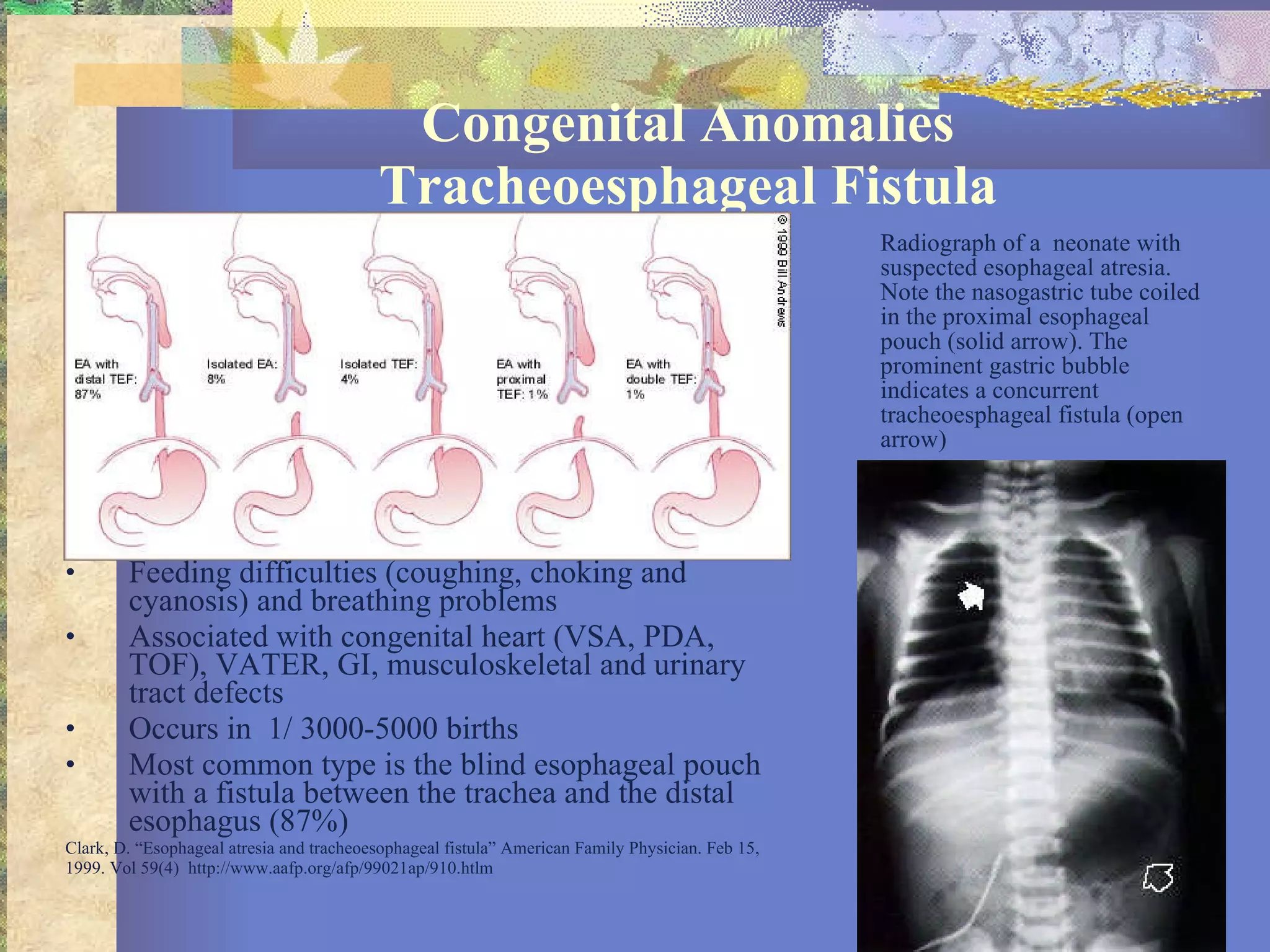 18 basics of pediatric airway anatomy, physiology and management | PPT
