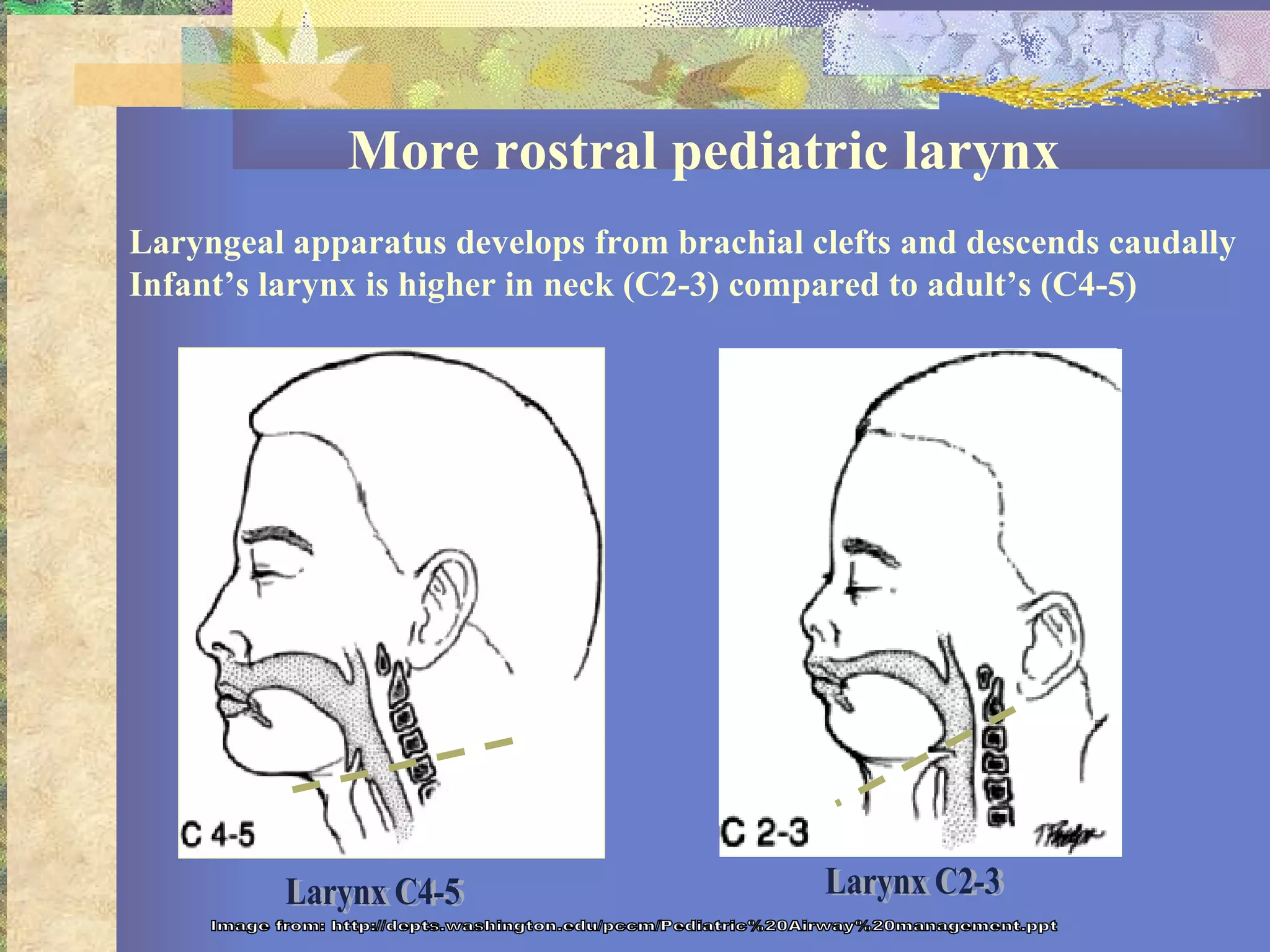 18 basics of pediatric airway anatomy, physiology and management | PPT