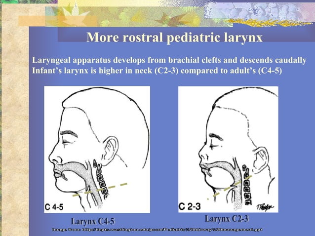 18 basics of pediatric airway anatomy, physiology and management | PPT ...