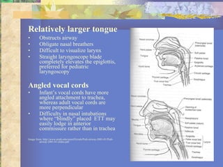 18 basics of pediatric airway anatomy, physiology and management | PPT