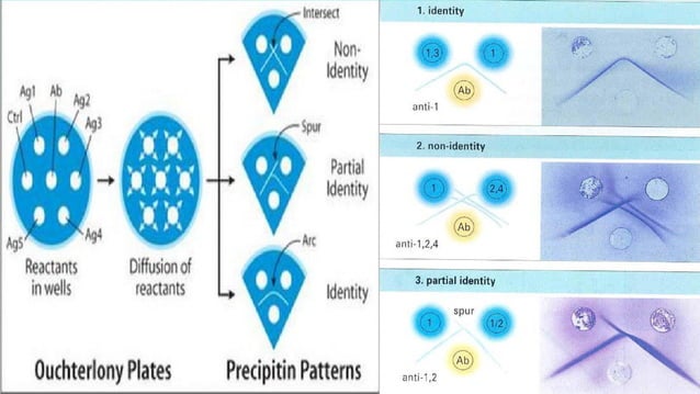 ouchterlony double diffusion method and immunoblotting | PPT
