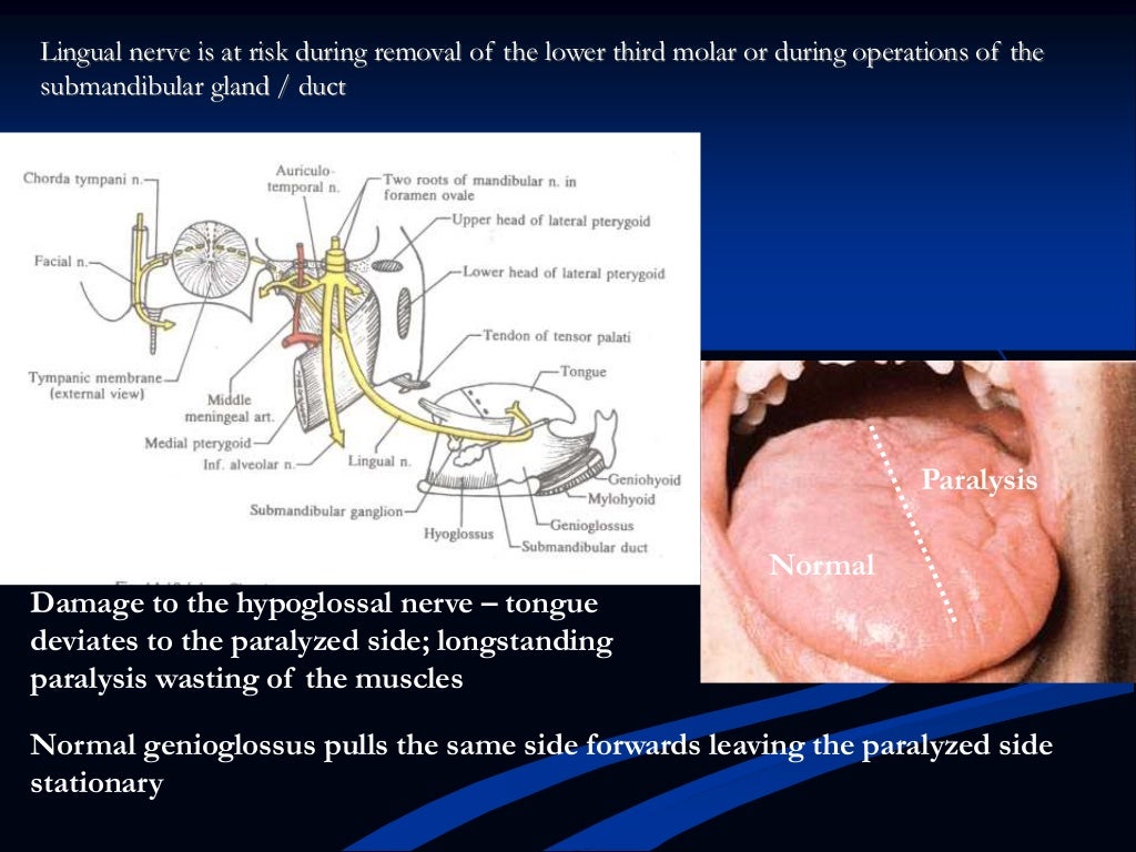 (18)hypoglossal nerve