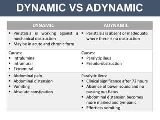 Management of intestinal obstruction | PPT