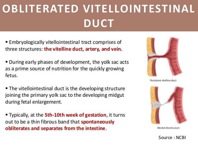 Management of intestinal obstruction