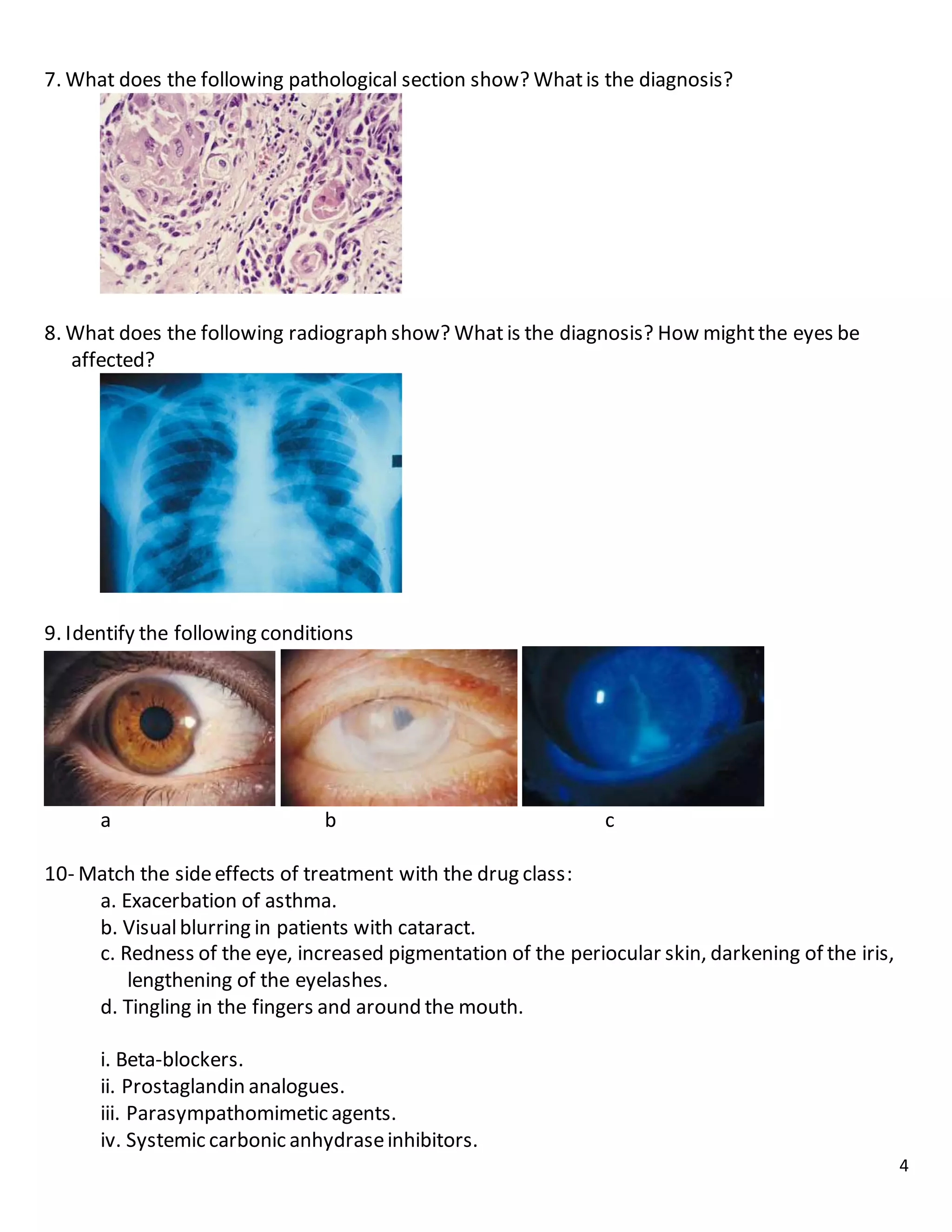 18 ophthalmology match diagnosis and signs | DOCX | Eye and Vision ...