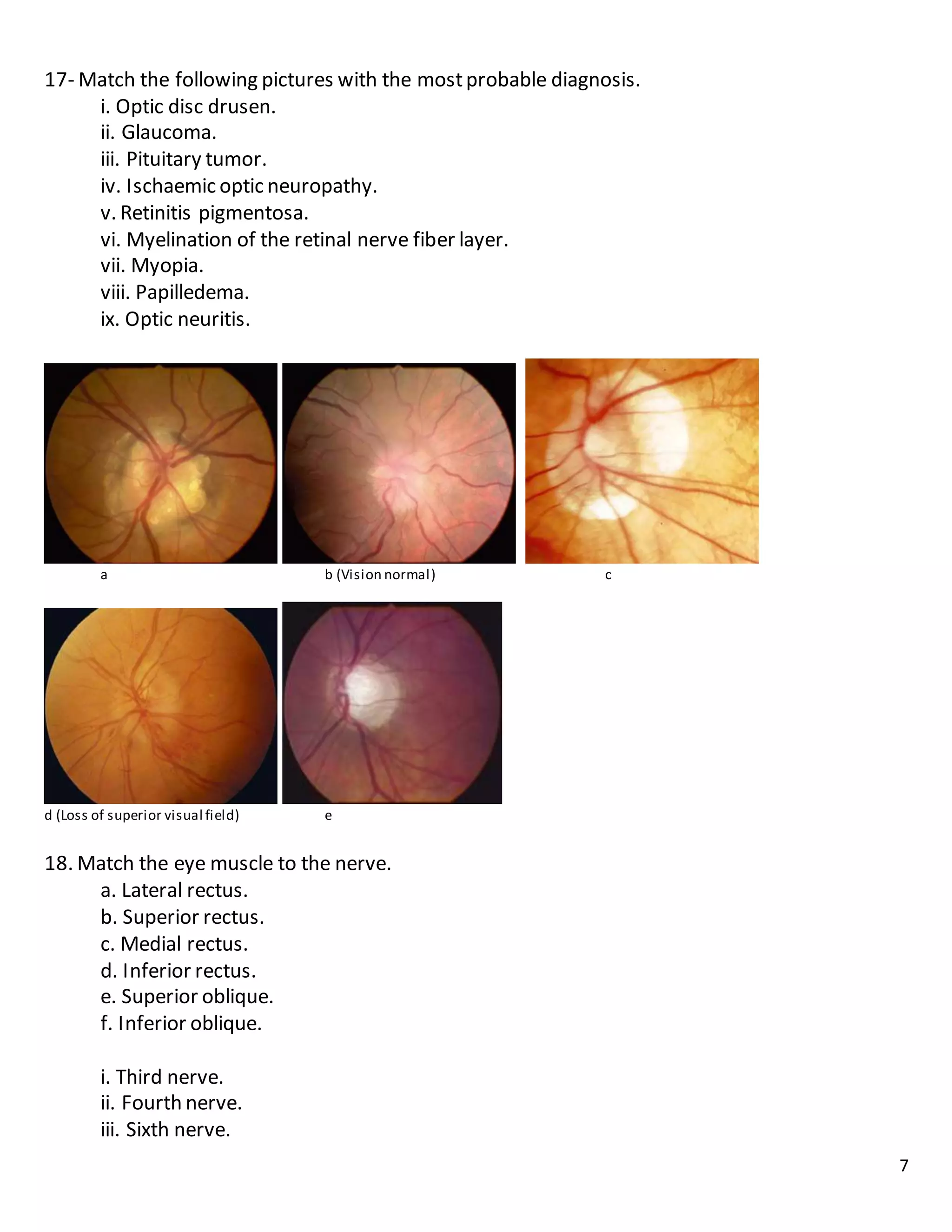 18 ophthalmology match diagnosis and signs | DOCX | Eye and Vision ...