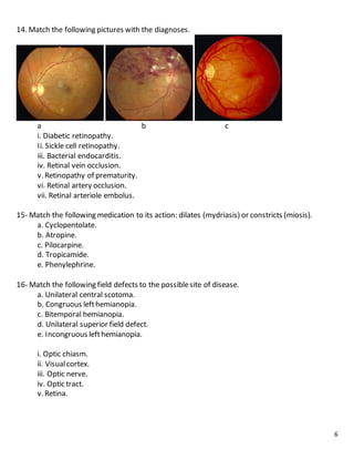 18 ophthalmology match diagnosis and signs | DOCX | Eye and Vision ...