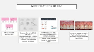Perioplastic surgeries- width of attached gingiva | PPTX