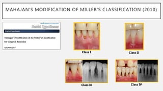 Perioplastic surgeries- width of attached gingiva | PPTX