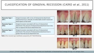 Perioplastic surgeries- width of attached gingiva | PPT