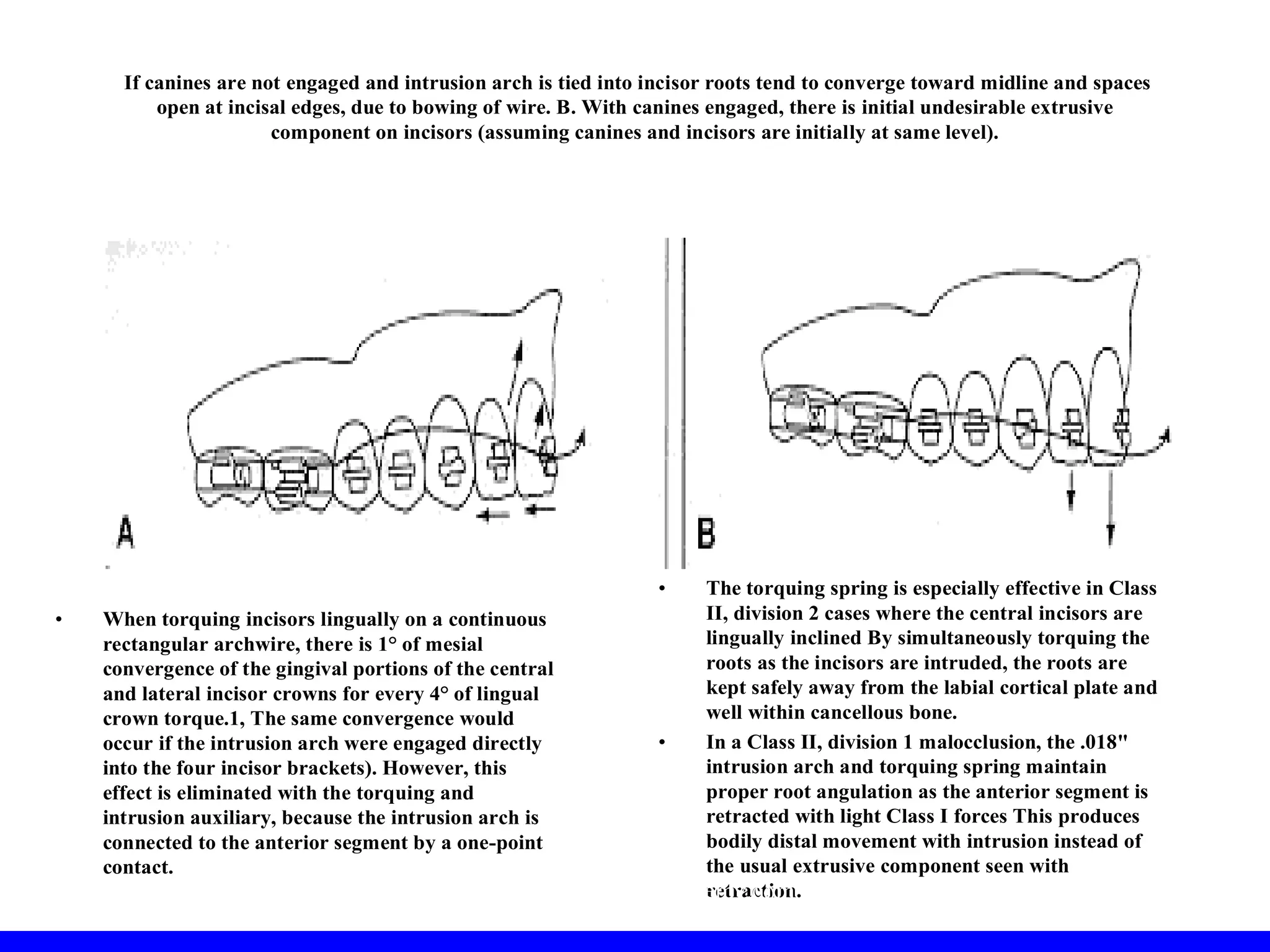 Simultaneous Torquing & Intrusion /certified fixed orthodontic courses by Indian dental academy ...