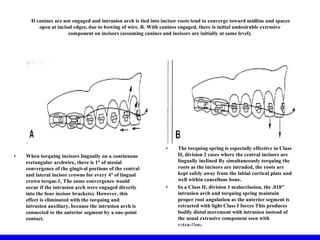 Simultaneous Torquing & Intrusion /certified fixed orthodontic courses ...