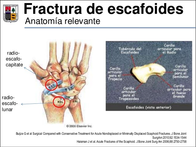 19. seminario fx escafoides, mtc y falanges. df