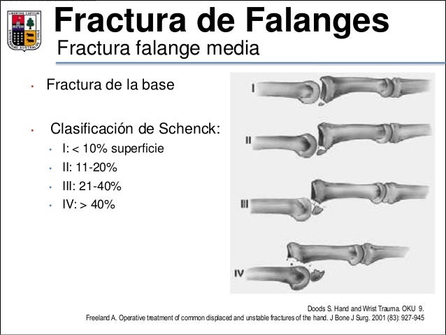 19. seminario fx escafoides, mtc y falanges. df