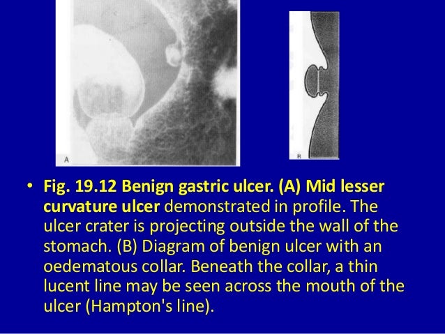 19 DAVID SUTTON PICTURES THE STOMACH AND DUODENUM