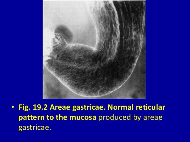 19 DAVID SUTTON PICTURES THE STOMACH AND DUODENUM