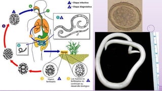 ascariasis | PPTX