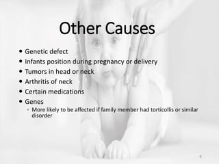 19. torticollis | PPTX