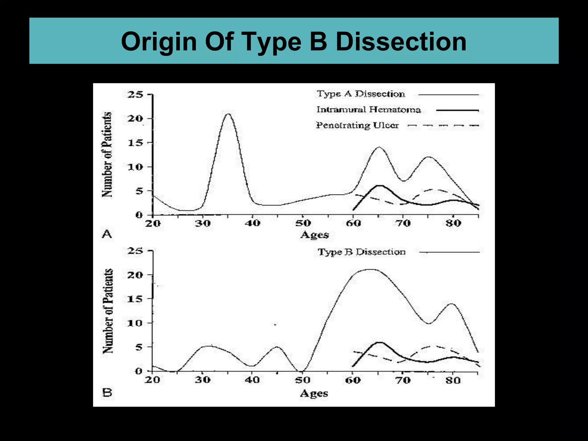 Type B AORTIC DISSECTION | PPTX