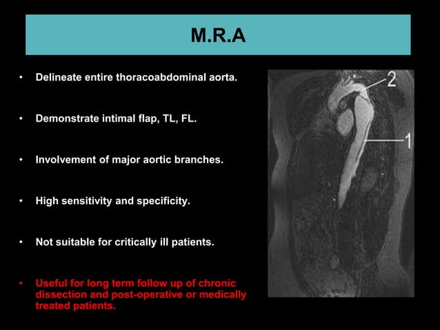 Type B AORTIC DISSECTION | PPTX