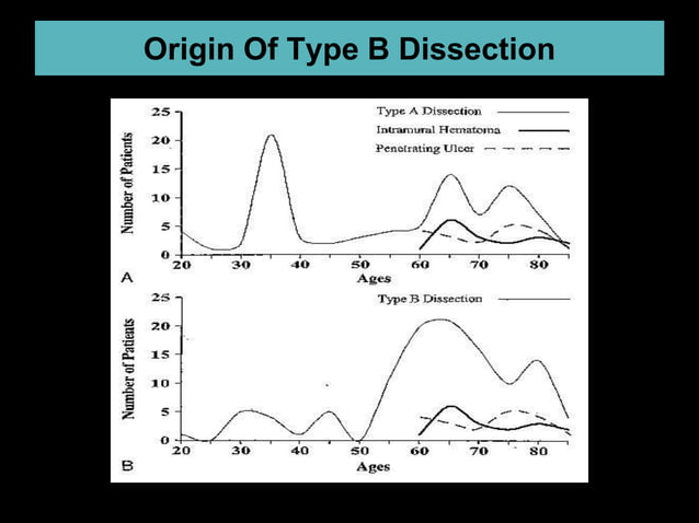 Type B AORTIC DISSECTION | PPTX